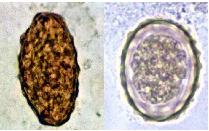 Hubungan Infeksi Ascaris lumbricoides Terhadap Hasil Uji Tusuk Kulit ...