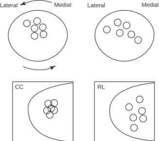 Sebaceous and Epidermal Inclusion Cysts - Breast Imaging Requisites ...