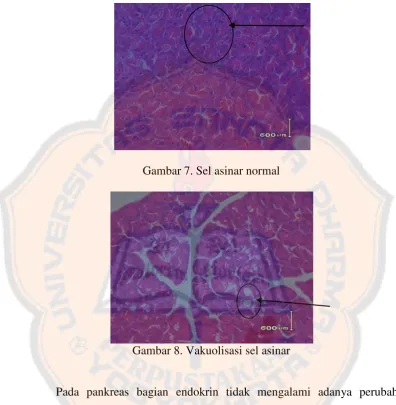 Pemeriksaan Histologis Pankreas - HASIL DAN PEMBAHASAN