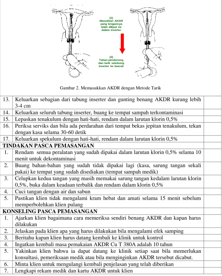 KETERAMPILAN PEMASANGAN DAN PENCABUTAN AKDR