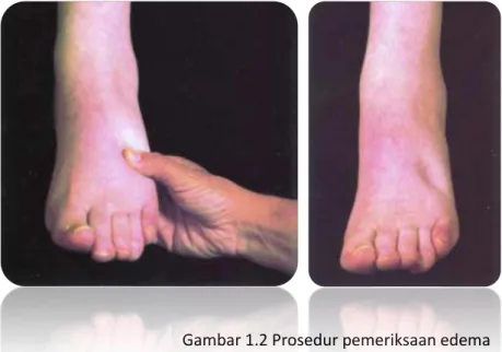 Prosedur Pemeriksaan Sirkulasi Perifer