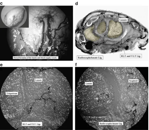 Radial-Shortening and Ulnar- Lengthening Operations